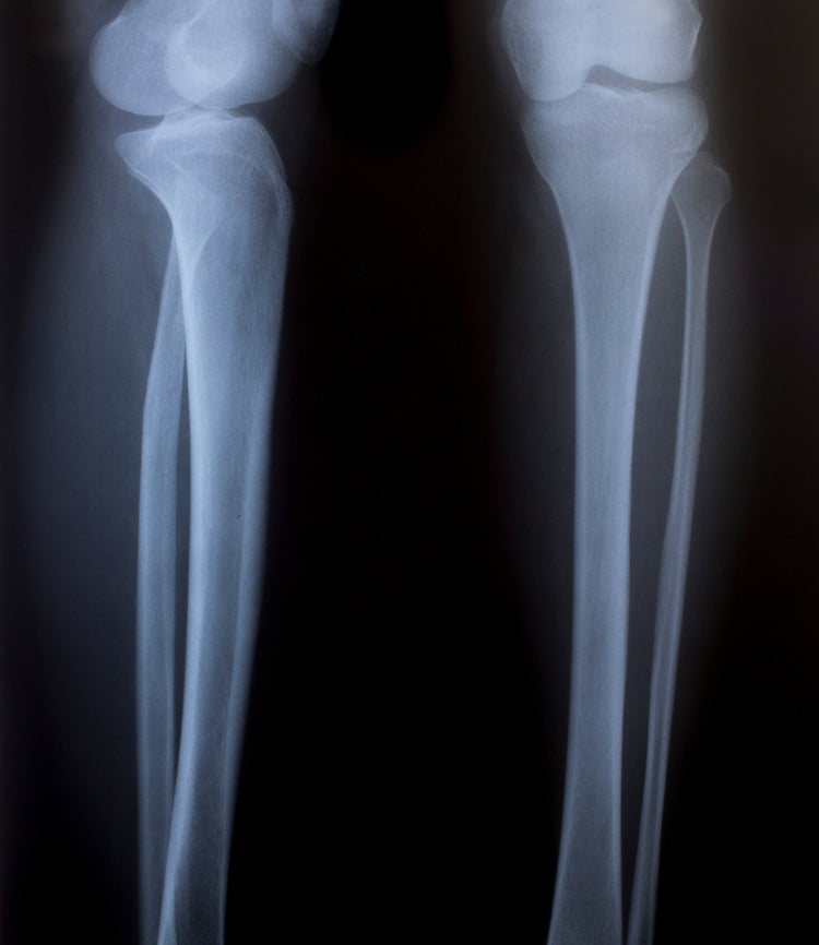 The Largest Human Bone: Fascinating Facts – Animus Medicus US